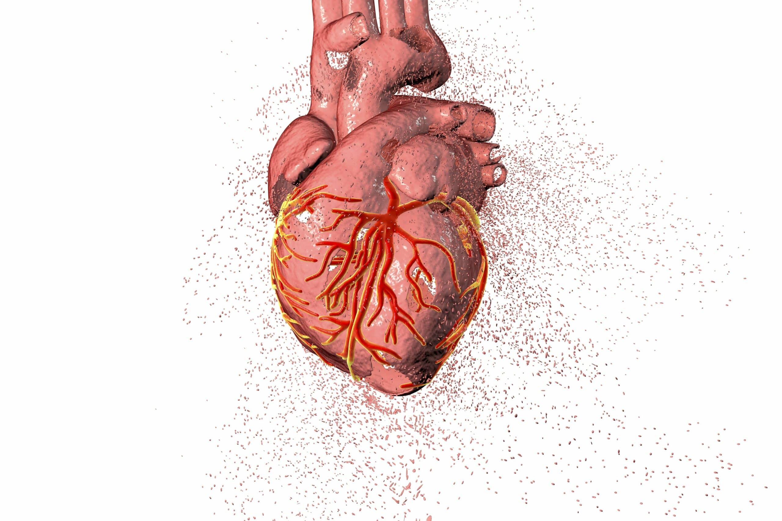 Lung Disease Ups Heart Disease Risk - Cardiology Innovations