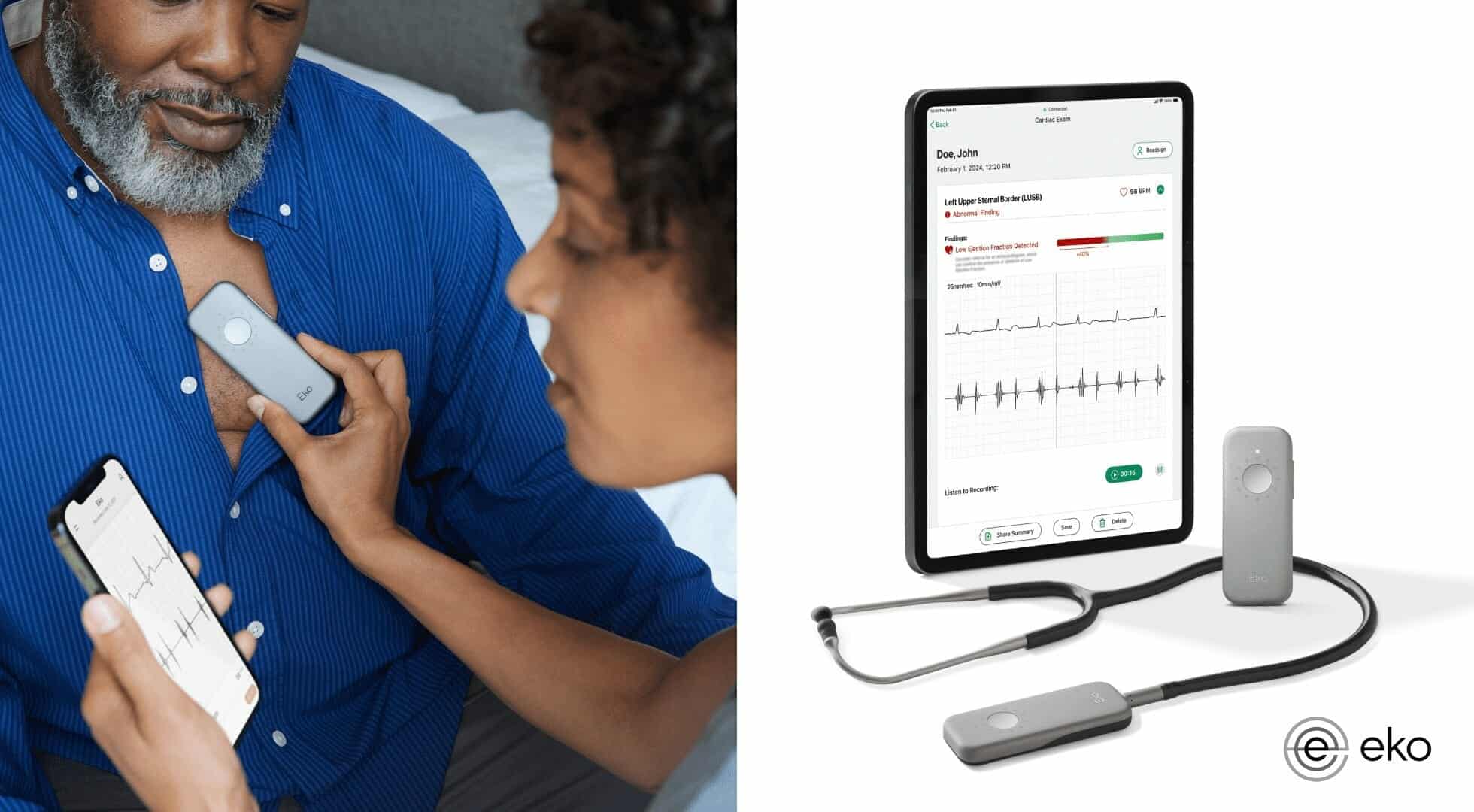 FDA Clears AI to Detect Heart Failure During Routine Check-ups ...